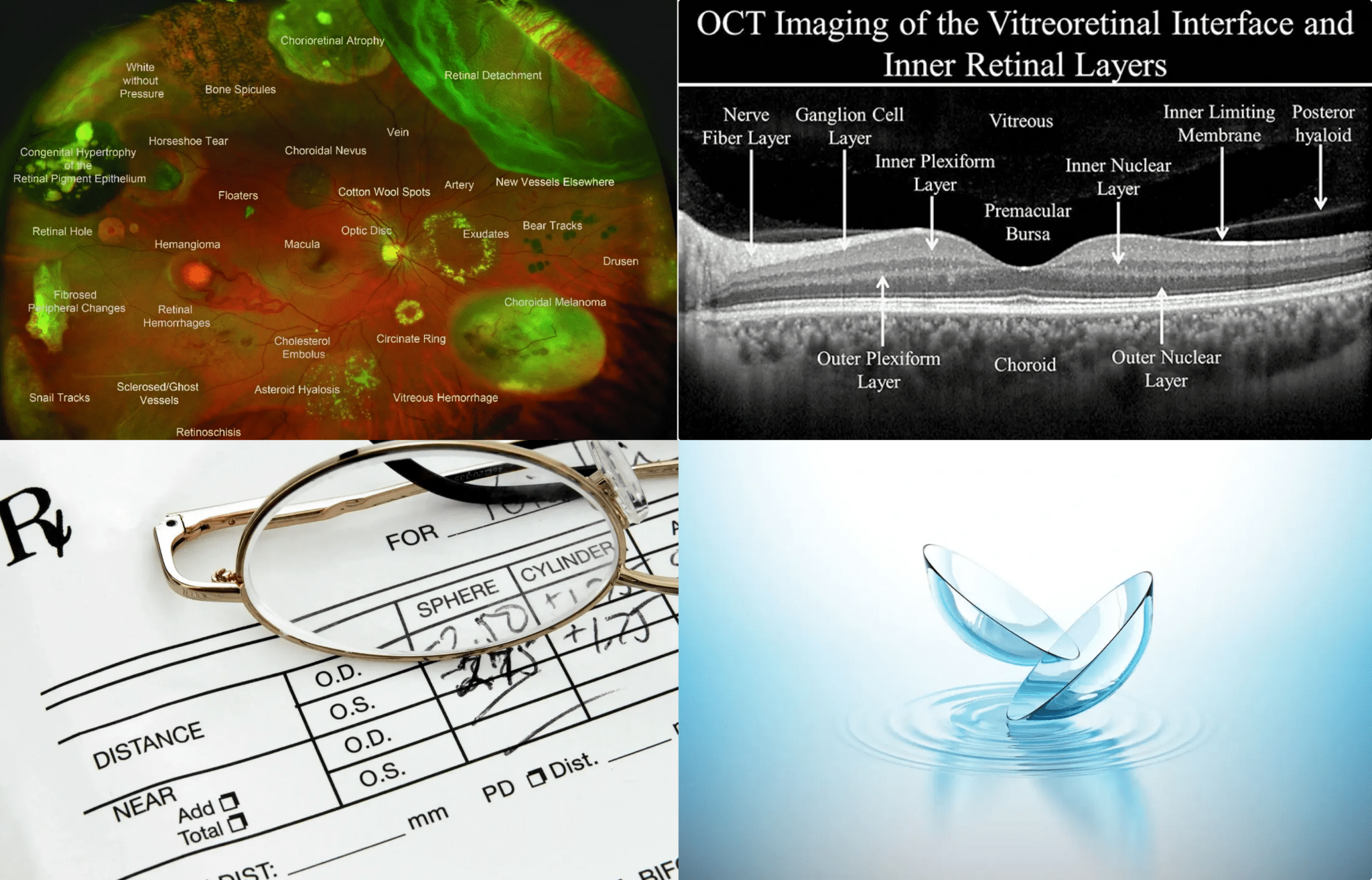 Eye Health Services | Carolina Optometry